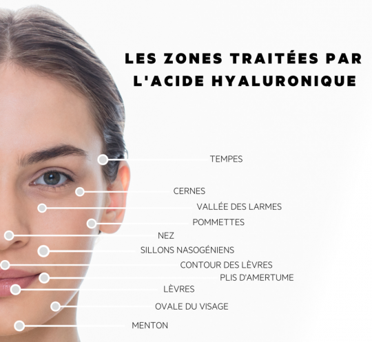 Injections Acide Hyaluronique – Centre dentaire Dentilay